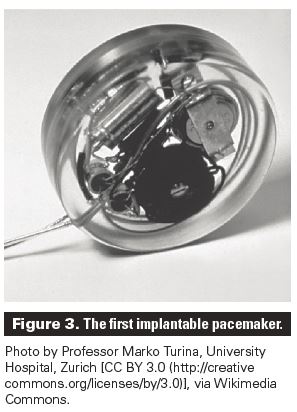 John Hopps and the pacemaker: A history and detailed overview of ...